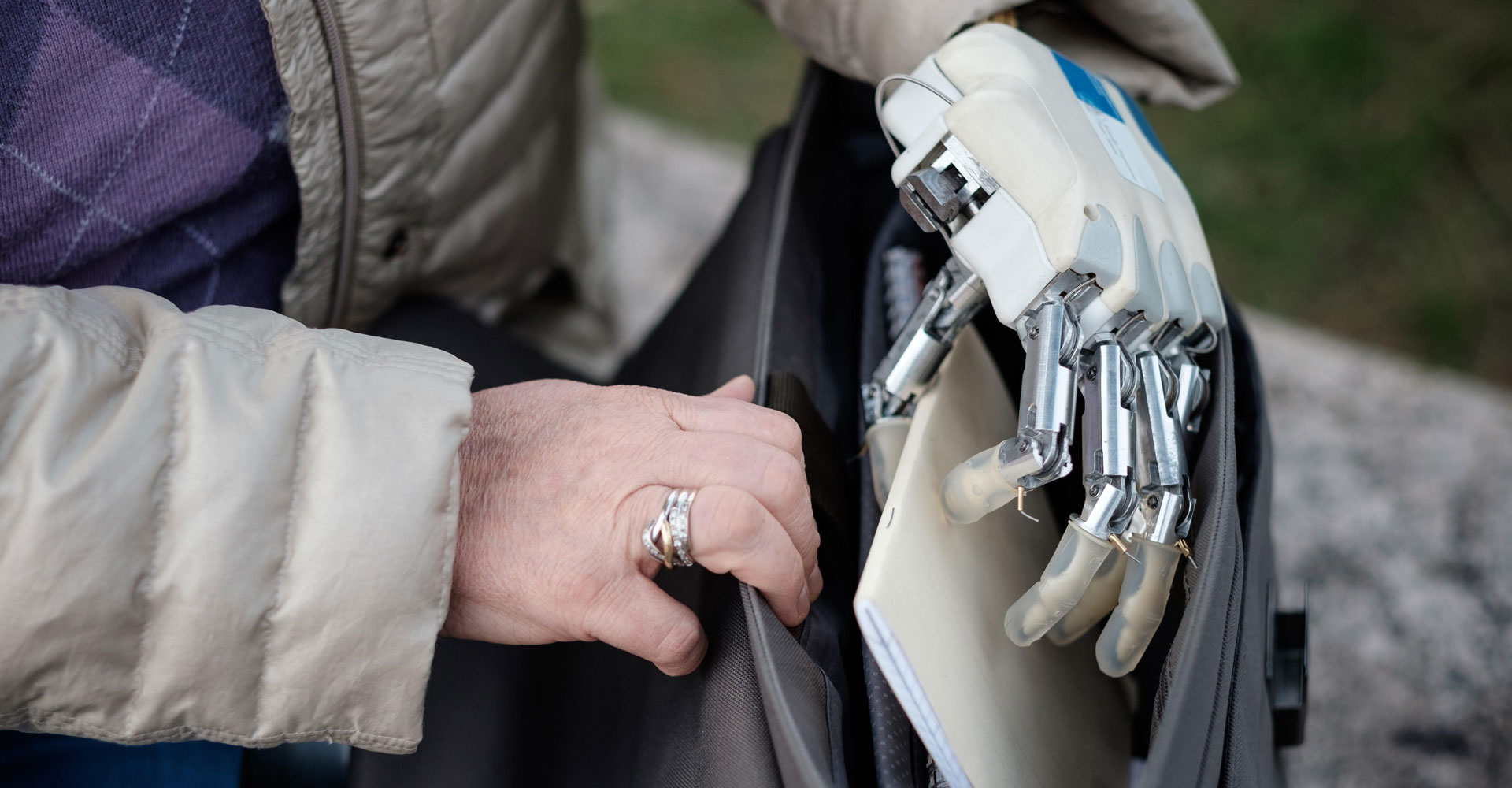 Handprothese sorgt für Tiefensensibilität